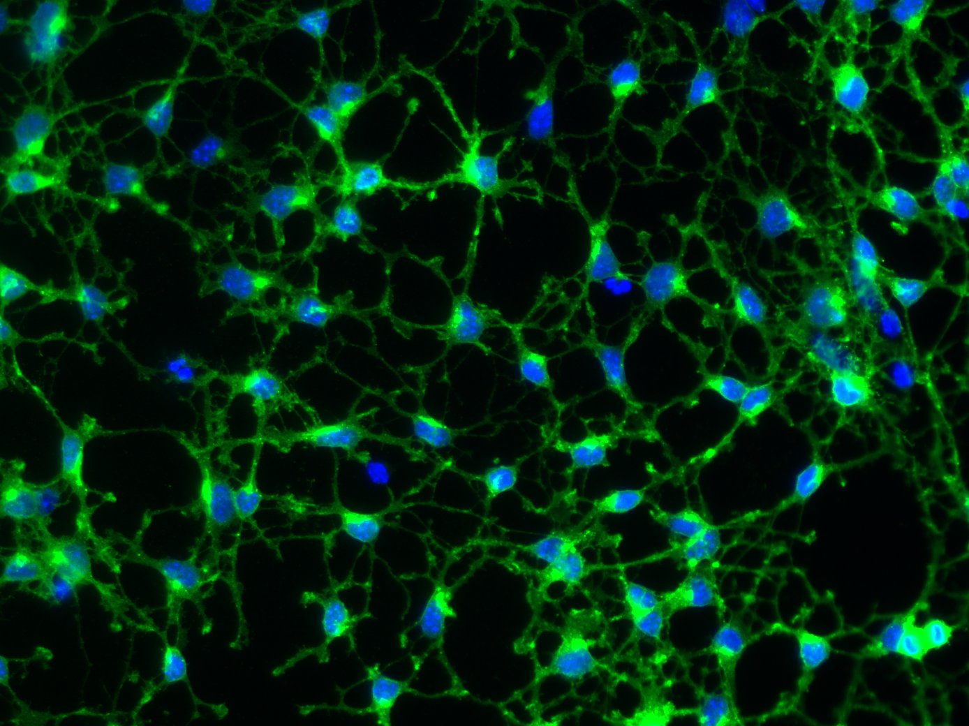 Mouse PDGF R alpha Antibody (AF1062) | Bio-Techne