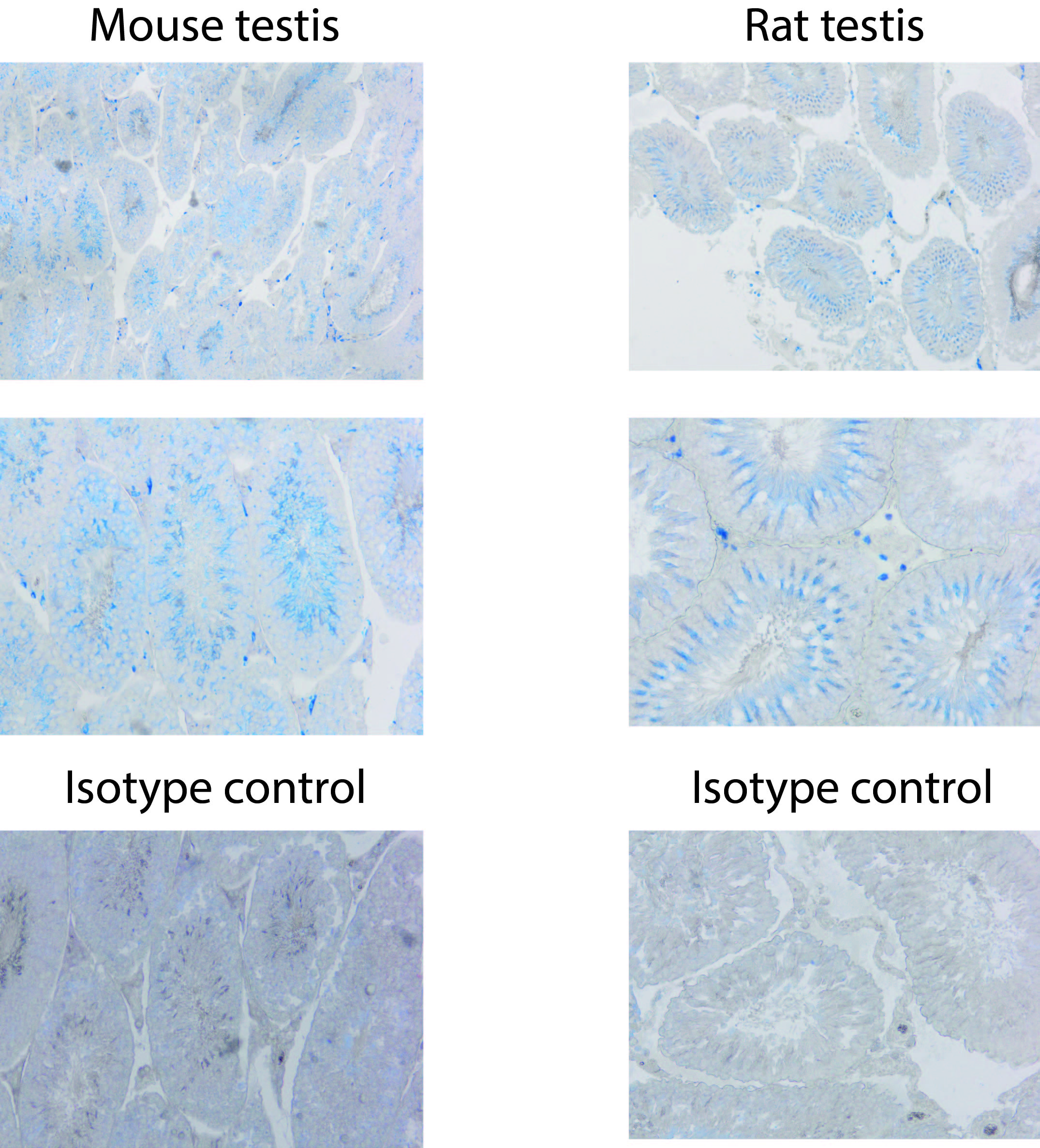 Mouse MMR/CD206 Antibody (AF2535) | Bio-Techne
