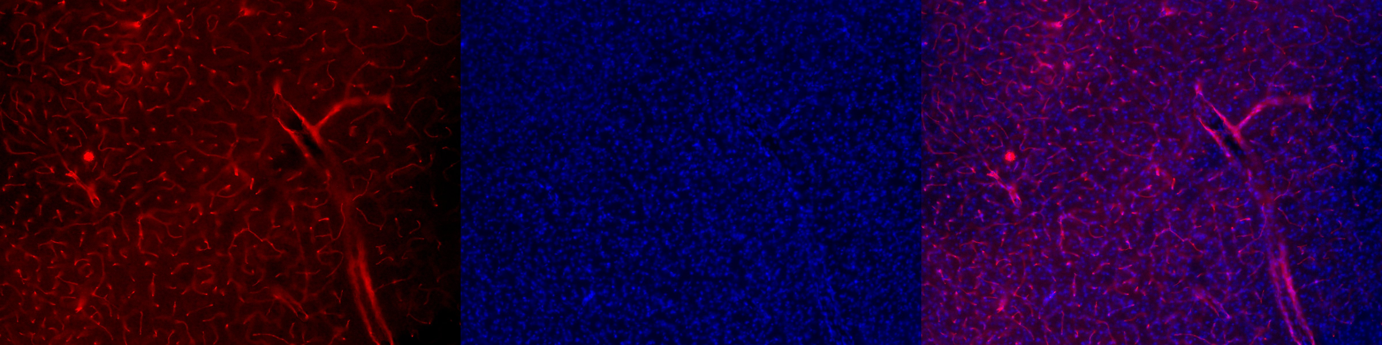 Human/Mouse/Rat CD31/PECAM‑1 Antibody (AF3628) | Bio-Techne