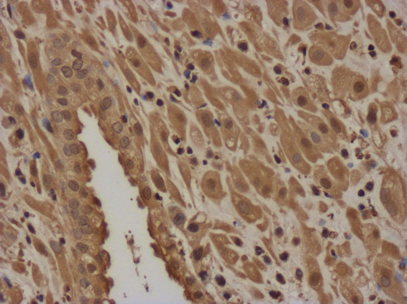 Mouse TIMP‑1 Antibody (AF980) | Bio-Techne