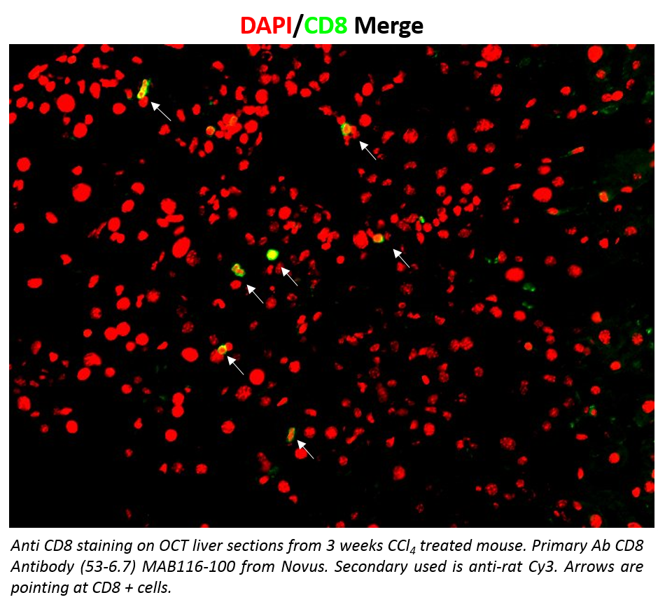 Mouse CD8 alpha Antibody (MAB116) | Bio-Techne