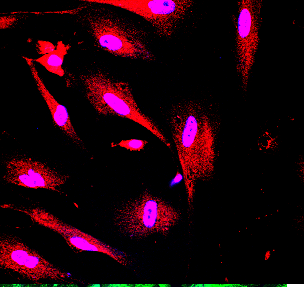 Human/Mouse alpha-Fetoprotein/AFP Antibody (MAB1368) | Bio-Techne