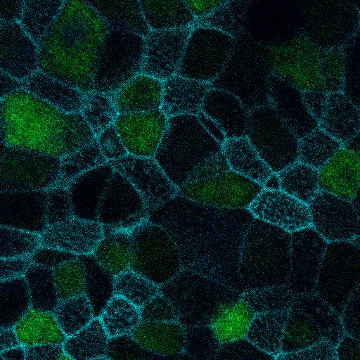 Human Uteroglobin/SCGB1A1 Antibody (MAB4218) | Bio-Techne