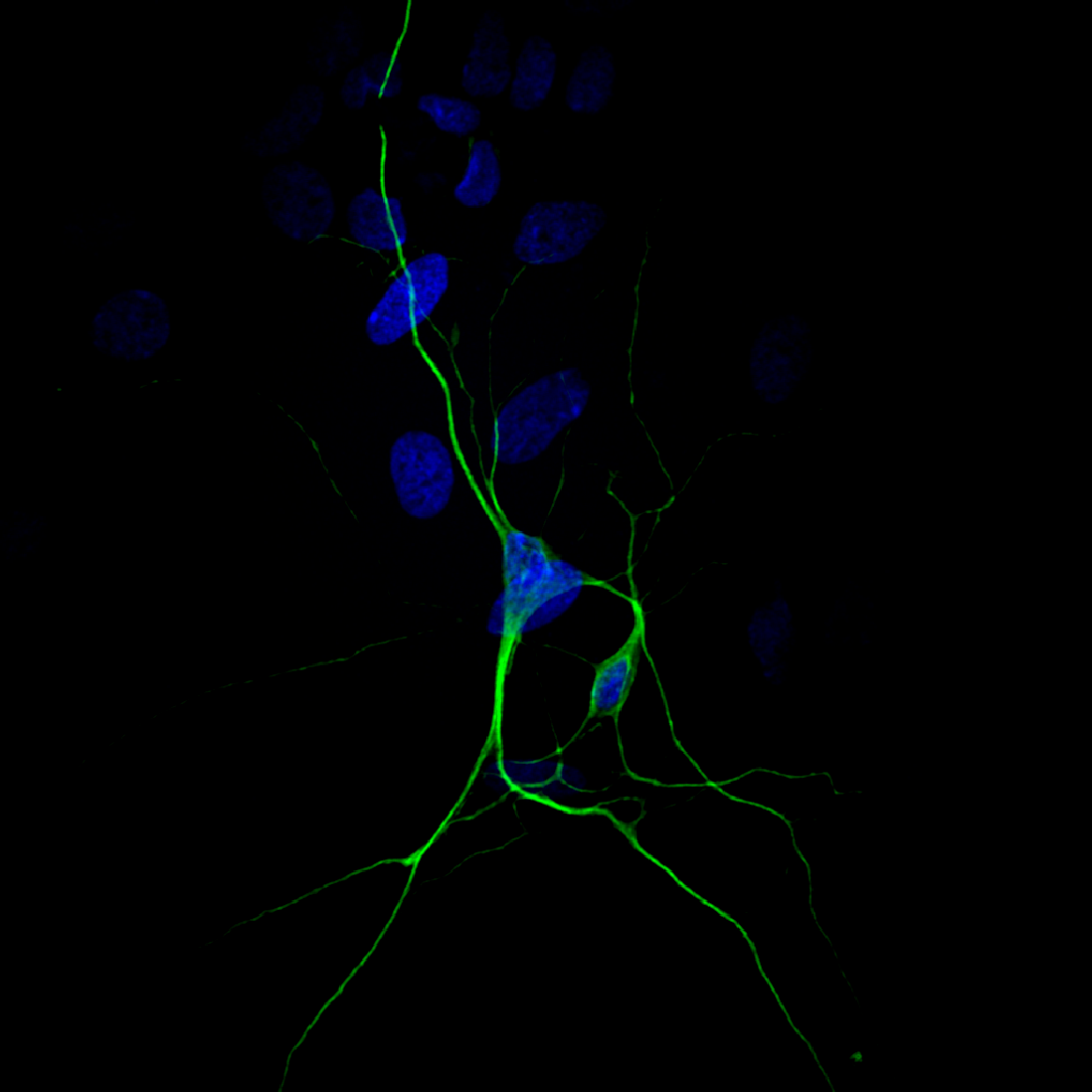 MAP2 Antibody (NB300-213) | Bio-Techne
