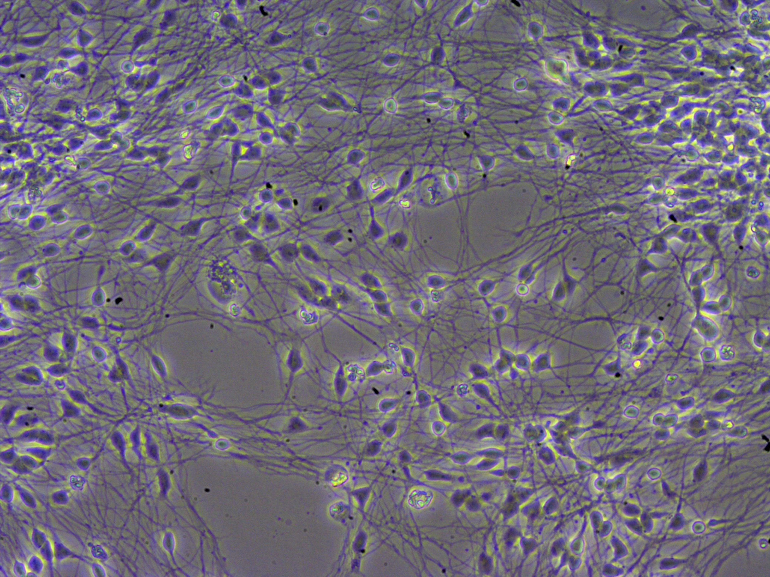 Recombinant Human GDNF Protein (212-GD) | Bio-Techne