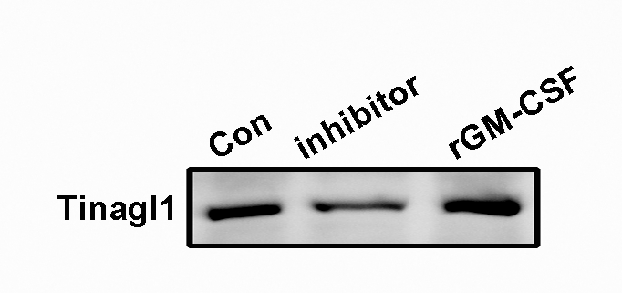 Recombinant Mouse GM-CSF Protein (415-ML) | Bio-Techne