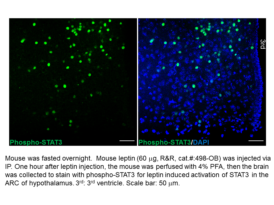 Recombinant Mouse Leptin Protein, CF (498-OB) | Bio-Techne