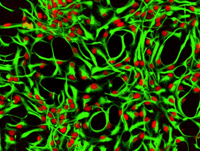 Recombinant Human Noggin Protein (6057-NG) | Bio-Techne