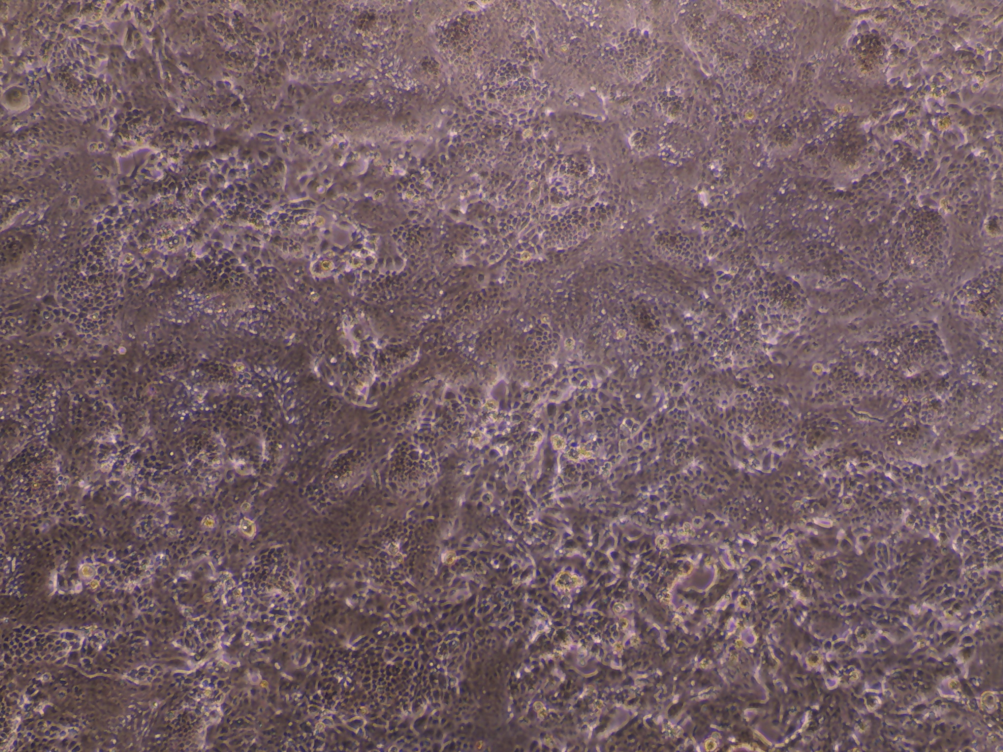 Recombinant Human/Mouse Wnt-5a Protein (645-WN) | Bio-Techne