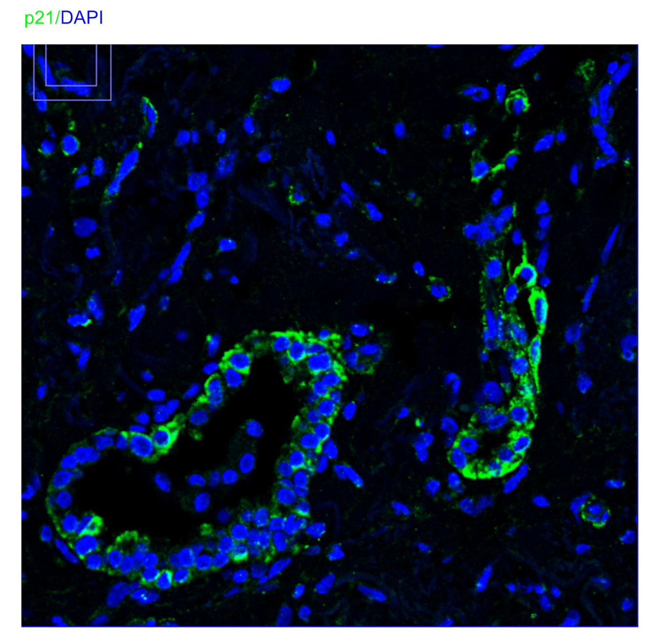 Human p21/CIP1/CDKN1A Antibody (AF1047) | Bio-Techne