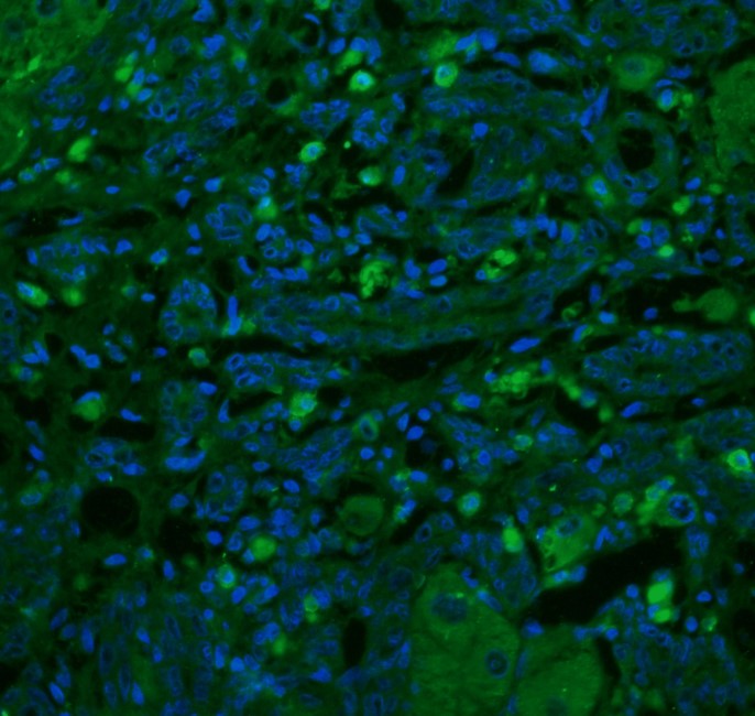Human/Mouse CD117/c-kit Antibody (AF1356) | Bio-Techne