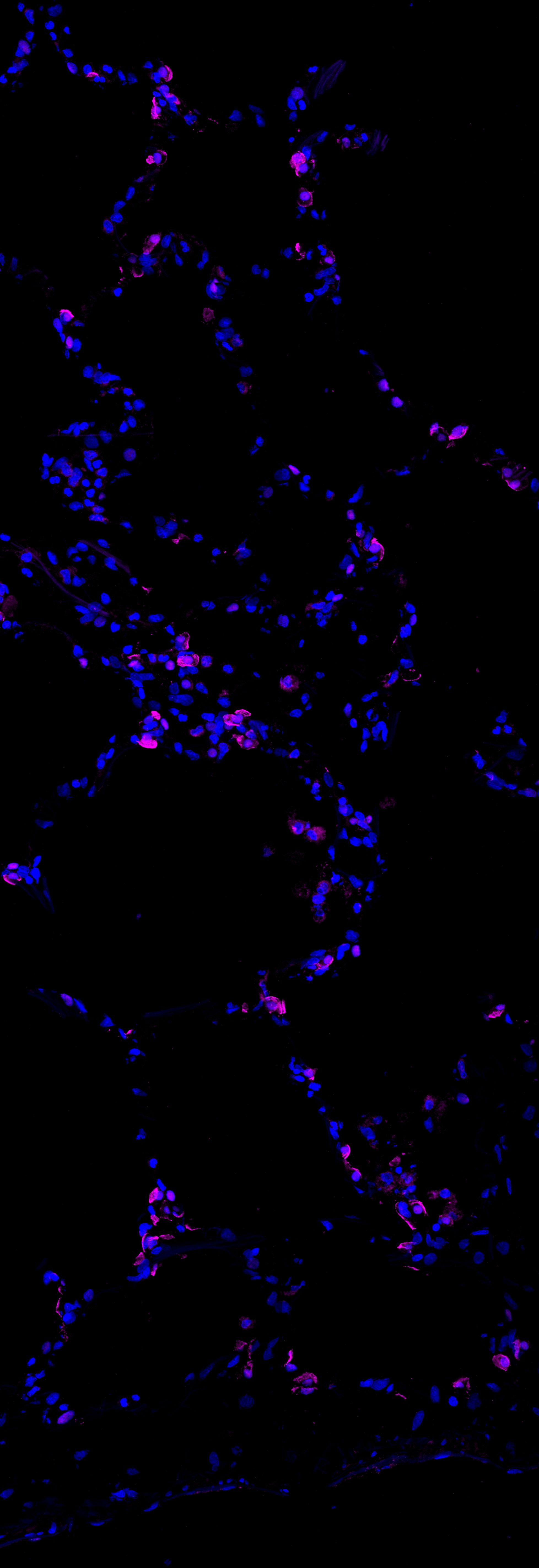 Human HNF‑3 beta/FoxA2 Antibody (AF2400) | Bio-Techne