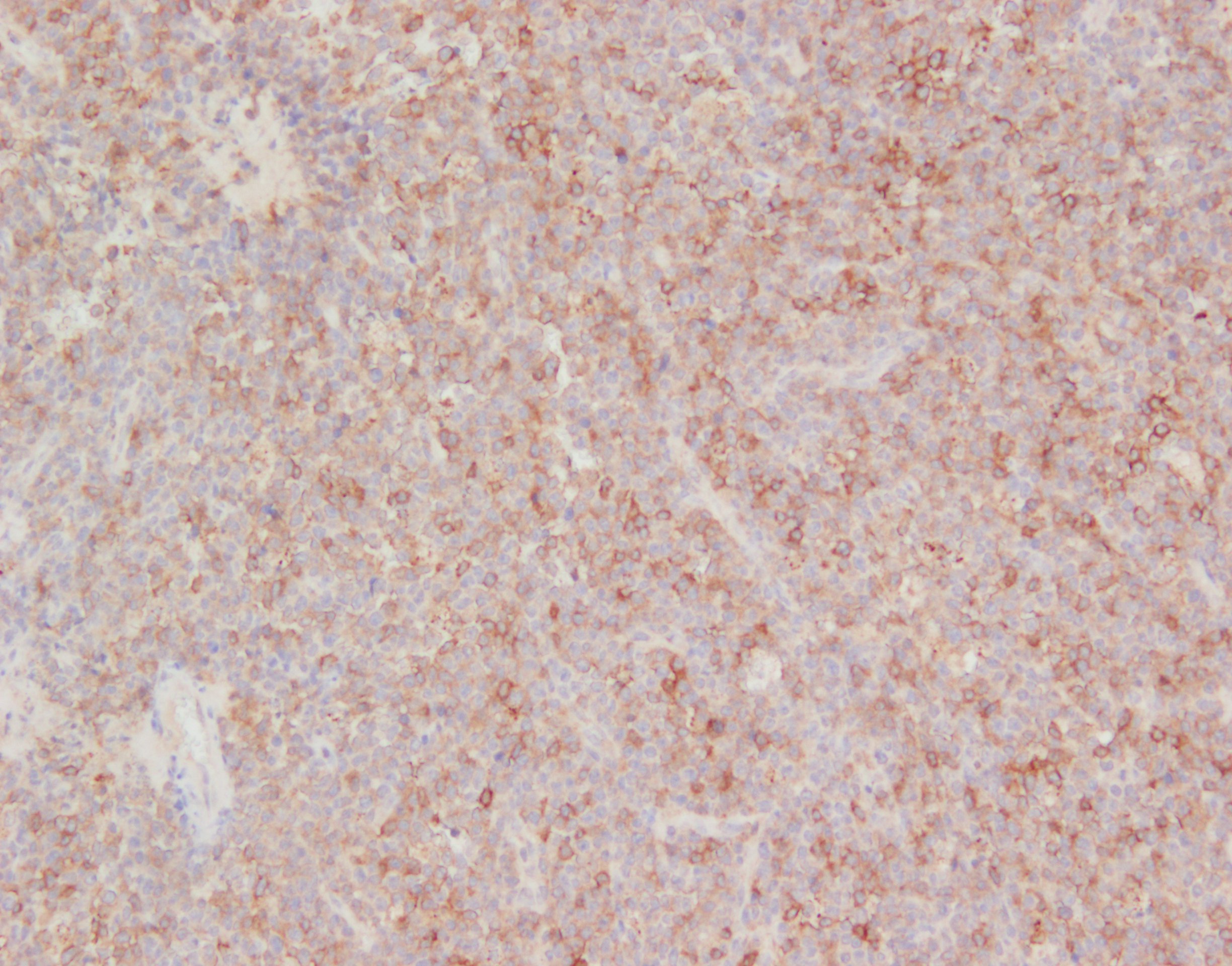 Human FCRL4/FcRH4 Antibody (AF2426) | Bio-Techne