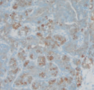 Human Osteoactivin/GPNMB Antibody (AF2550) | Bio-Techne