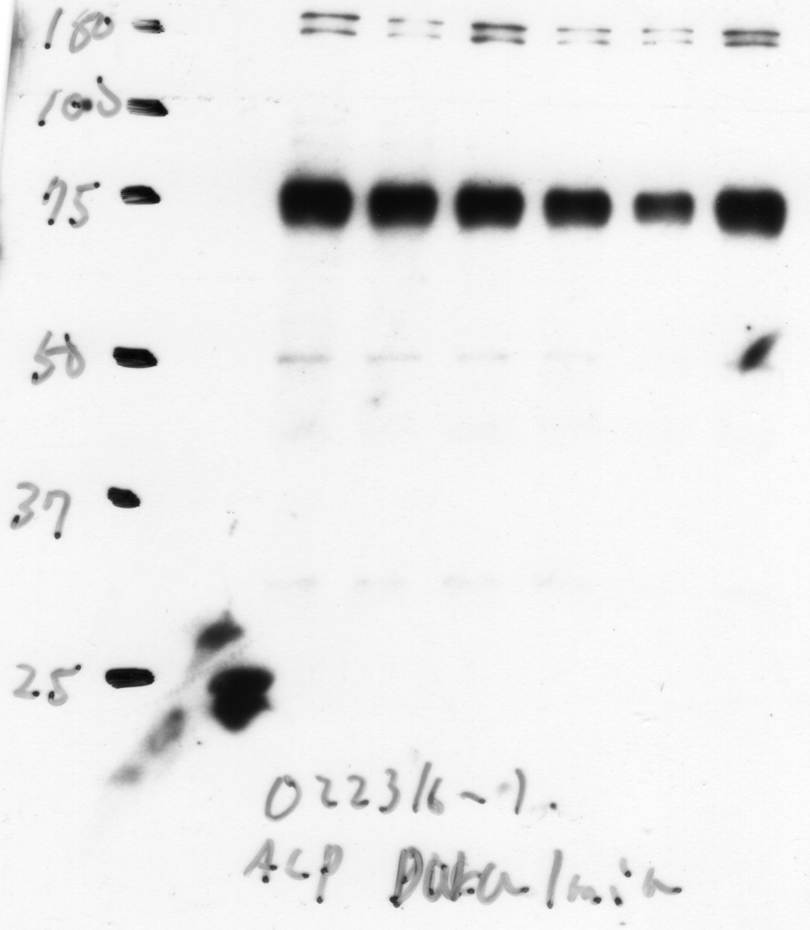 Mouse Alkaline Phosphatase/ALPL Antibody (AF2910) | Bio-Techne
