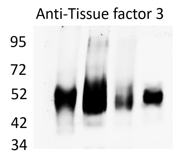 Mouse Coagulation Factor III/Tissue Factor Antibody (AF3178) | Bio-Techne