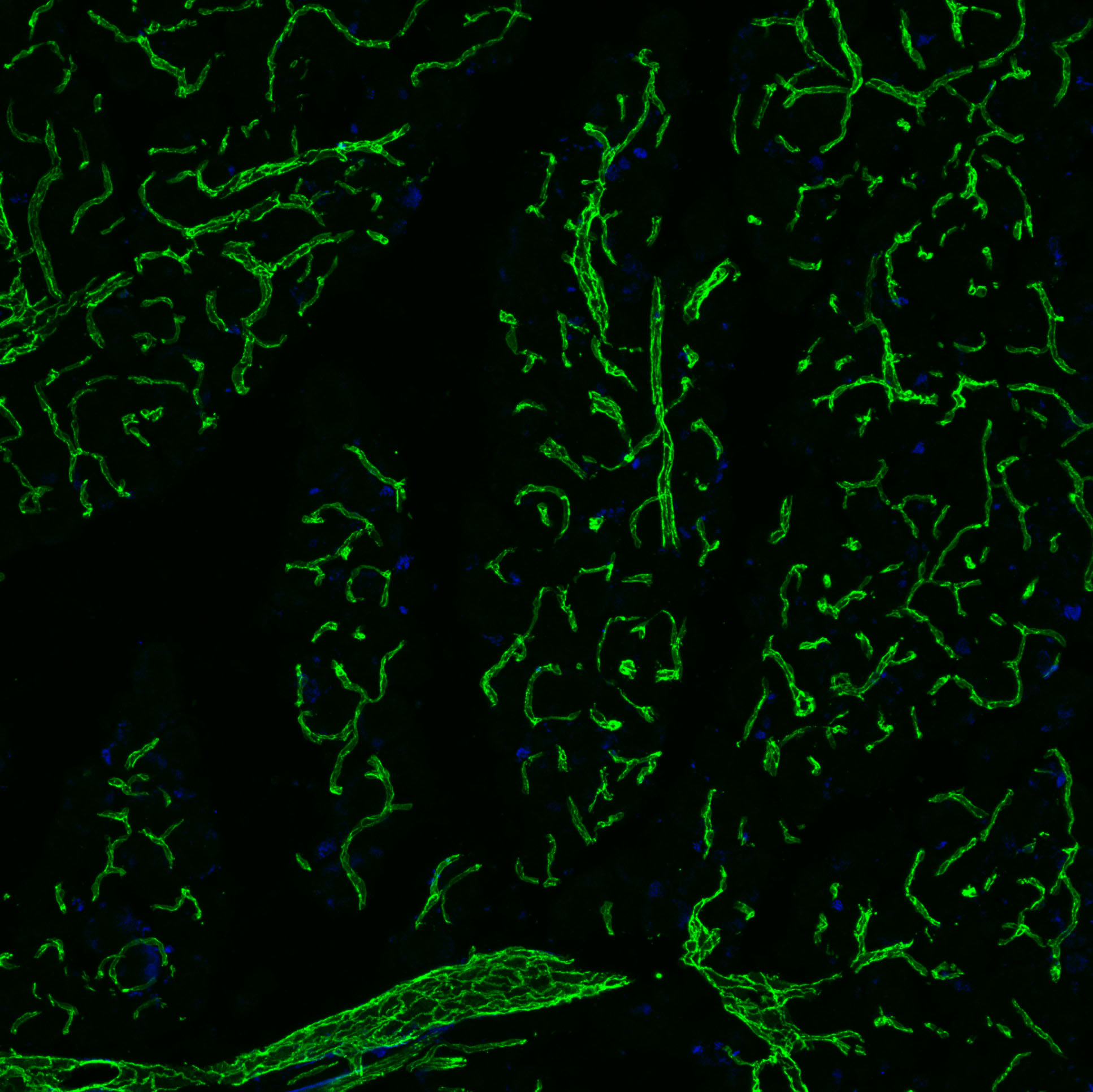 Human/Mouse/Rat CD31/PECAM‑1 Antibody (AF3628) | Bio-Techne