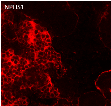 Human Nephrin Antibody (AF4269) | Bio-Techne