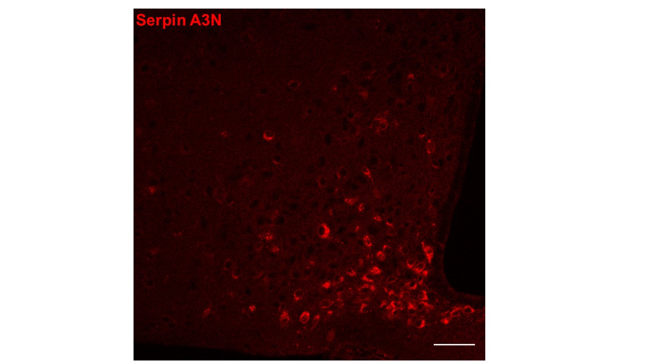 Mouse Serpin A3N Antibody (AF4709) | Bio-Techne