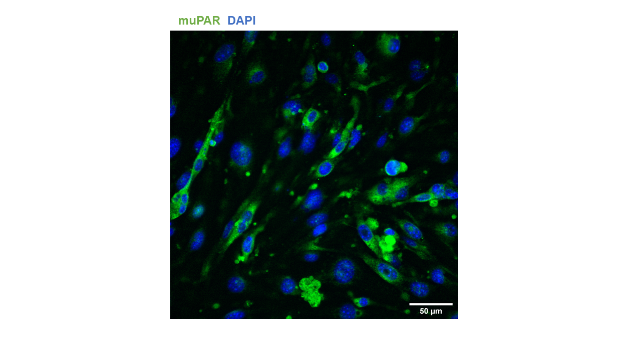 Mouse uPAR Antibody (AF534) | Bio-Techne