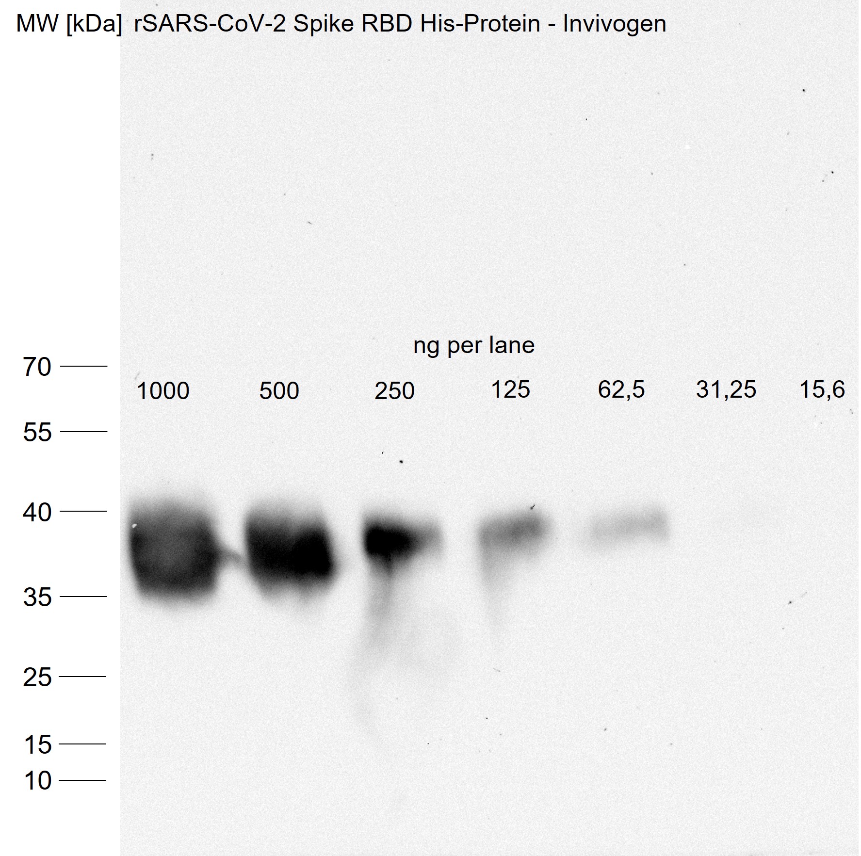 SARS-CoV-2 Spike RBD Antibody (MAB10540) | Bio-Techne