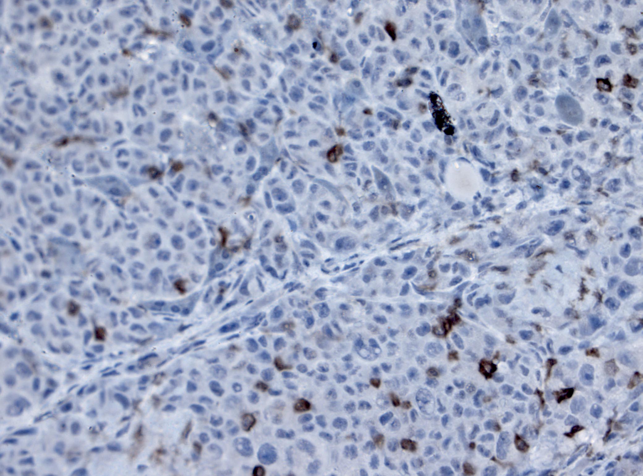 Human Alkaline Phosphatase/ALPL Antibody (MAB1448) | Bio-Techne