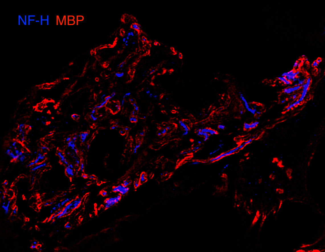 Human/Mouse/Rat MBP Antibody (MAB42282) | Bio-Techne