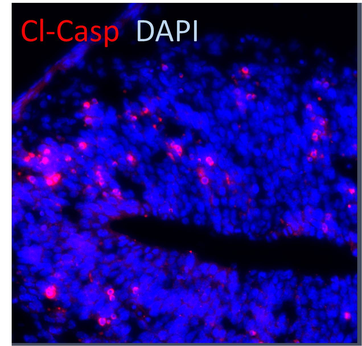 Human/Mouse Cleaved Caspase‑3 (Asp175) Antibody (MAB835) | Bio-Techne